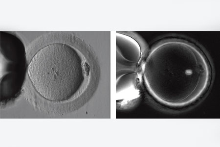 Spindle Imaging System | DPU IVF Lab, Pune